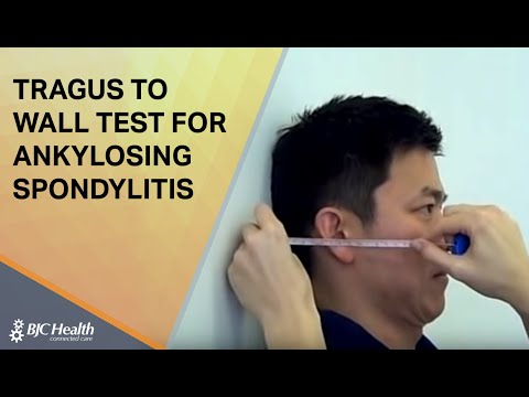 Complete Video: Tragus to Wall Test For Ankylosing Spondylitis ...