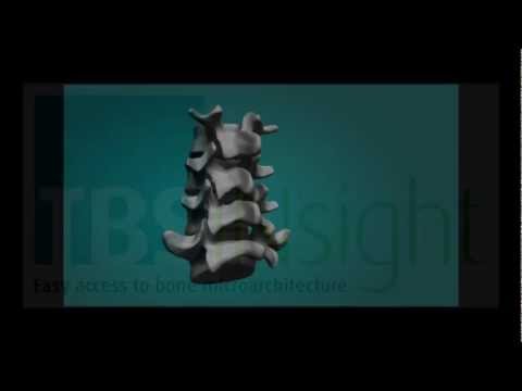 TBS iNsight