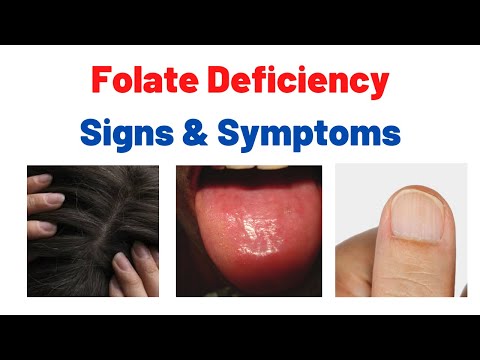 Folate Deficiency Signs & Symptoms, Folate Deficiency Anemia vs B12 Deficiency Anemia