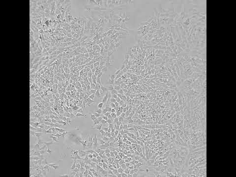 iPSC derived neural crest cell scratch assay (wound healing assay) time-lapse | Using CytoSMART Lux2