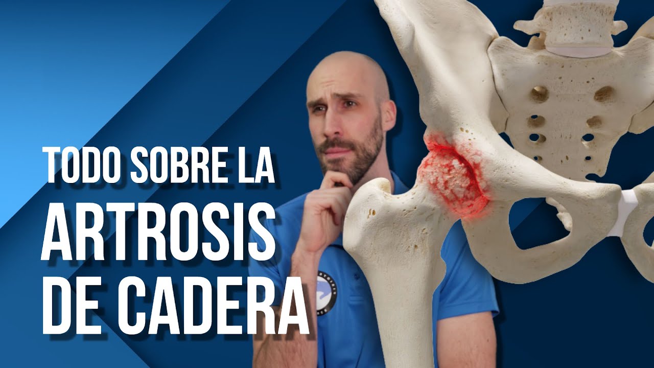¿por Qué Se Produce La Artrosis En La Cadera ¿qué Soluciones Hay Salud