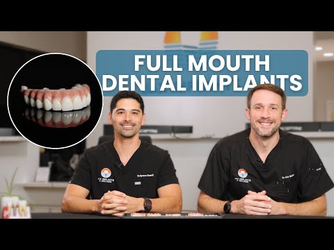 Full Mouth Dental Implants: Everything You Need to Know and Cost