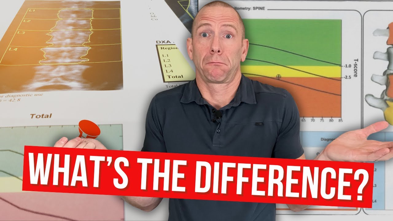 DEXA vs. REMS: Understanding the Best Imaging Tool for Osteoporosis ...