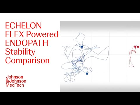Comparing Stability of Powered vs Non-Powered Stapling Systems: ECHELON FLEX | J&J MedTech