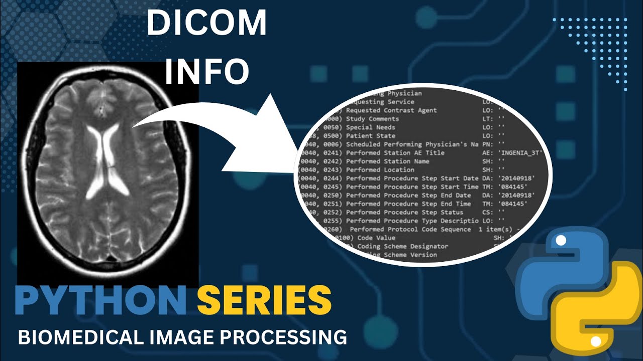 Dicom info in Python | Biomedical Image Processing