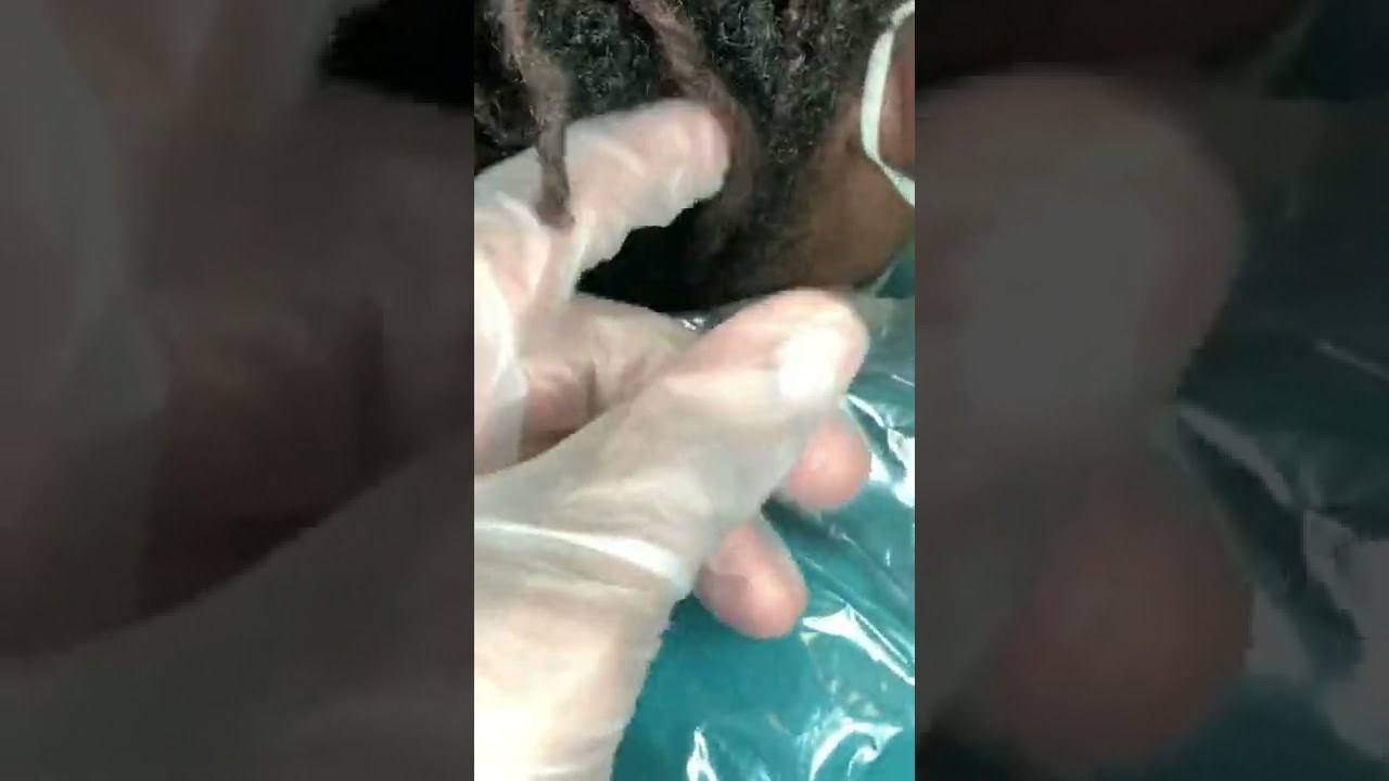 can you repair locs thinning at the roots??