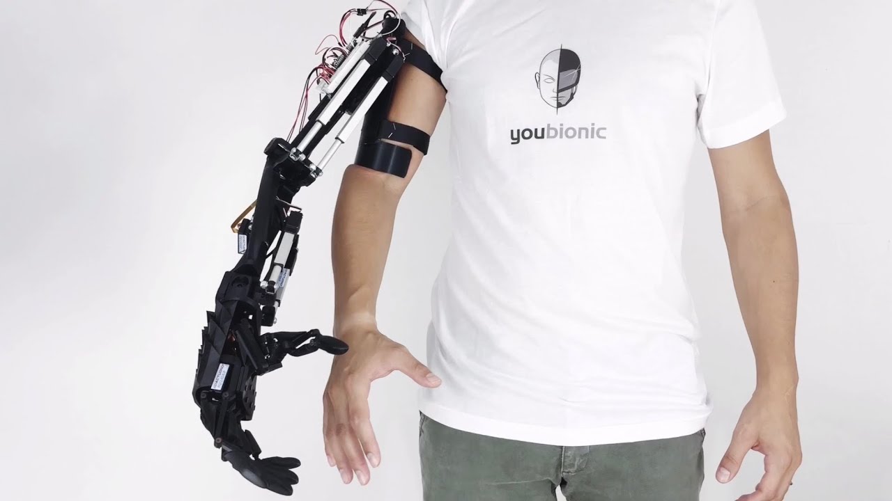 Youbionic Arm