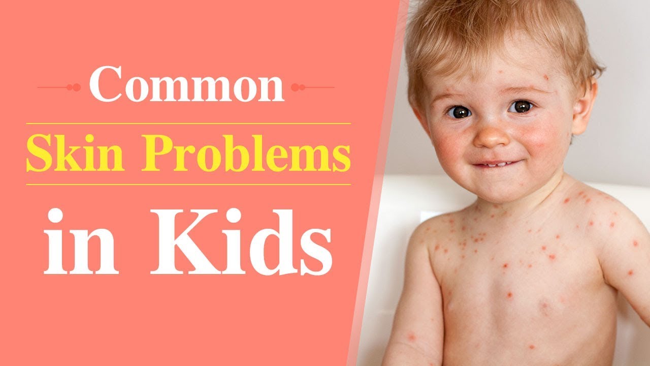 6 Common Skin Problems in Children