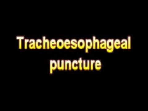 What Is The Definition Of Tracheoesophageal puncture