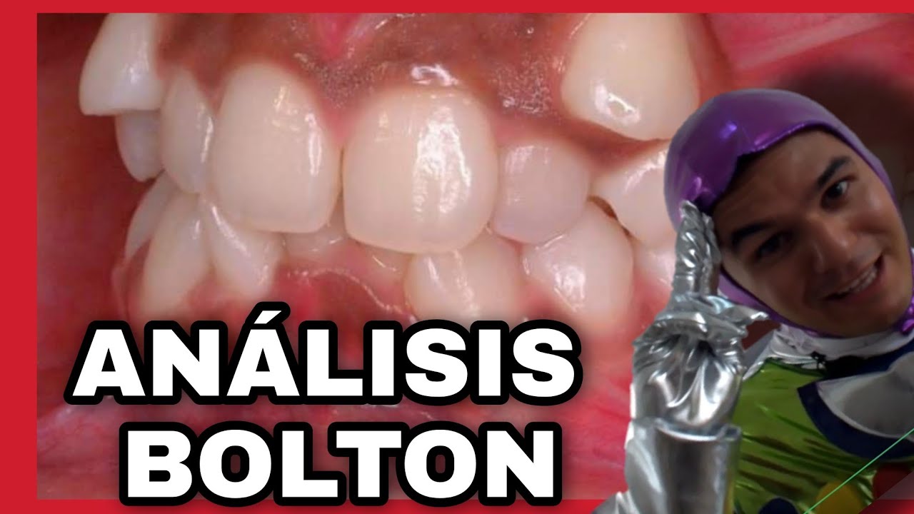 Bolton Analysis