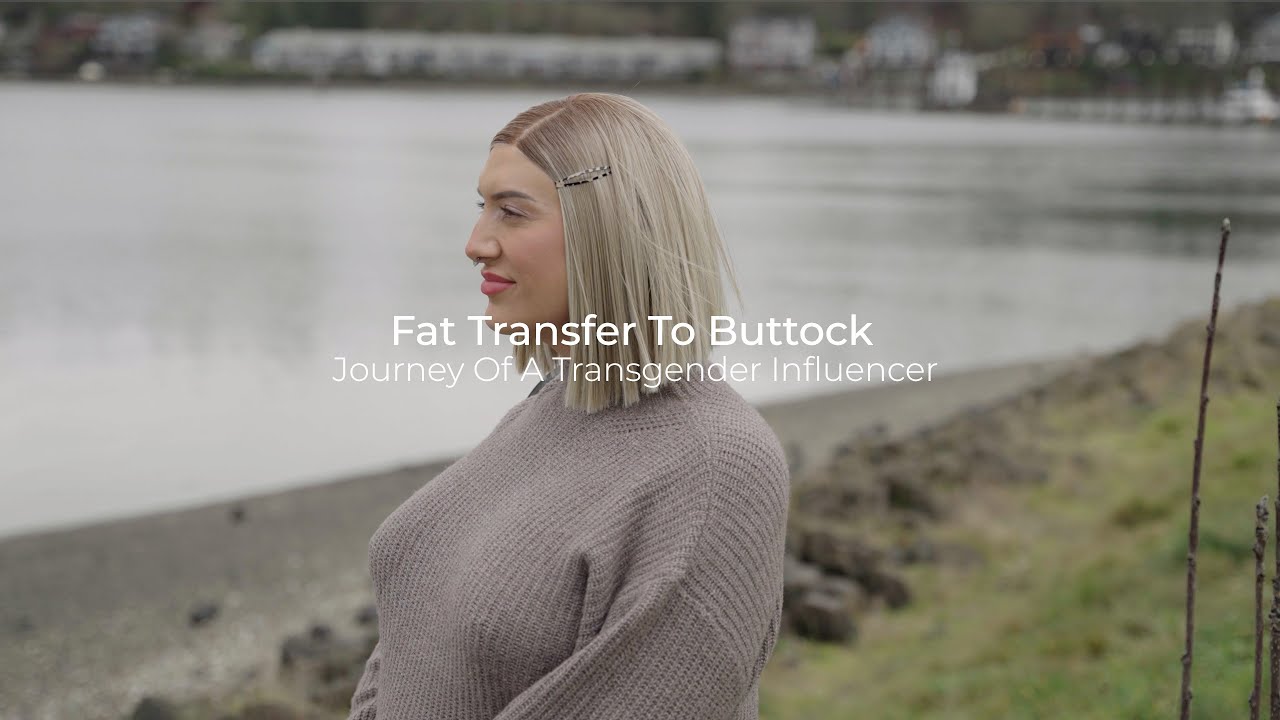 Fat Transfer To Buttock: Journey of a Transgender Influencer