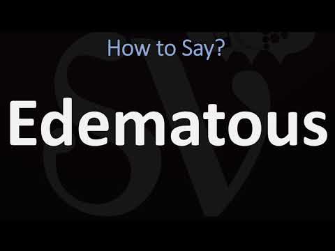 How to Pronounce Edematous? (CORRECTLY)
