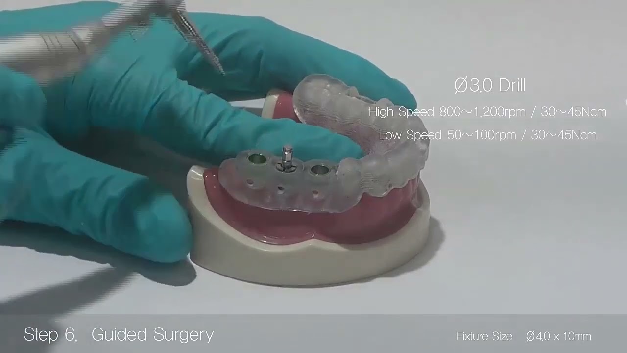 Neo NaviGuide Surgery Manual