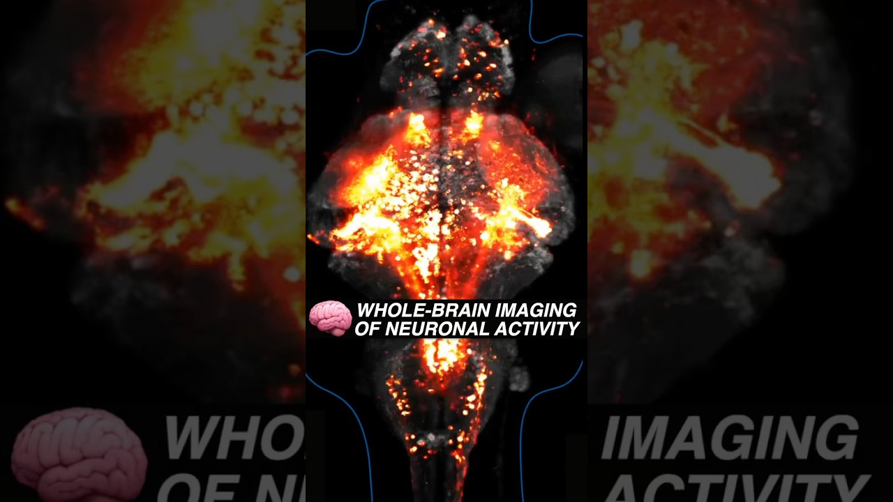 Whole-brain imaging of neuronal activity #Neuroscience #Neuroplasticity #Brain #Science #Microscope