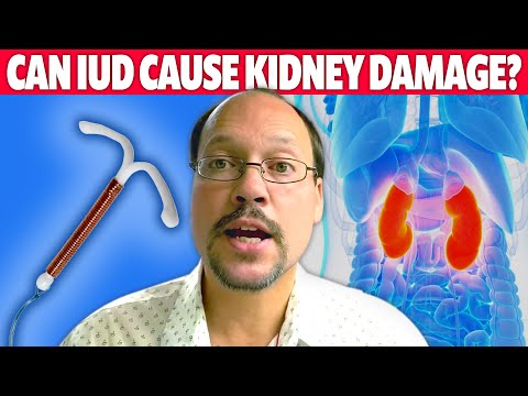 lntrauterine Device (IUD) And Kidney Disease? Is It Safe?