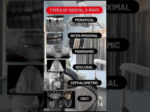 which type of dental x-ray  is safest???