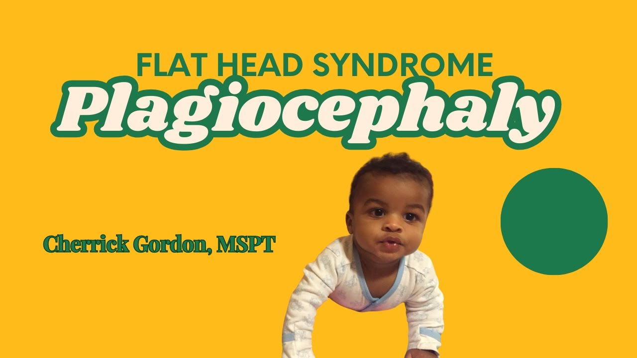 Effective At-Home Solutions For Plagiocephaly (Flat Head Syndrome) Expert Tips and Techniques.