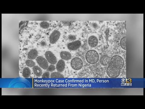 Monkeypox Virus Confirmed In Maryland Resident