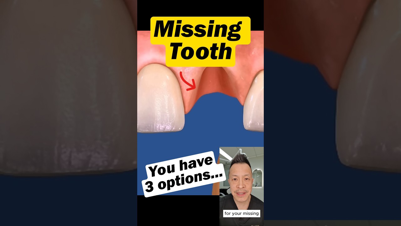 3 Options for Replacing a Missing Tooth (Dentist Explains) #dentallan #dentist #shorts
