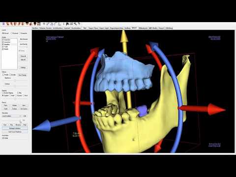 Invivo™ 5.4.5 Training Series: Introduction to Medical Design Studio