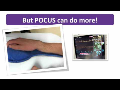 POCUS in Fractures