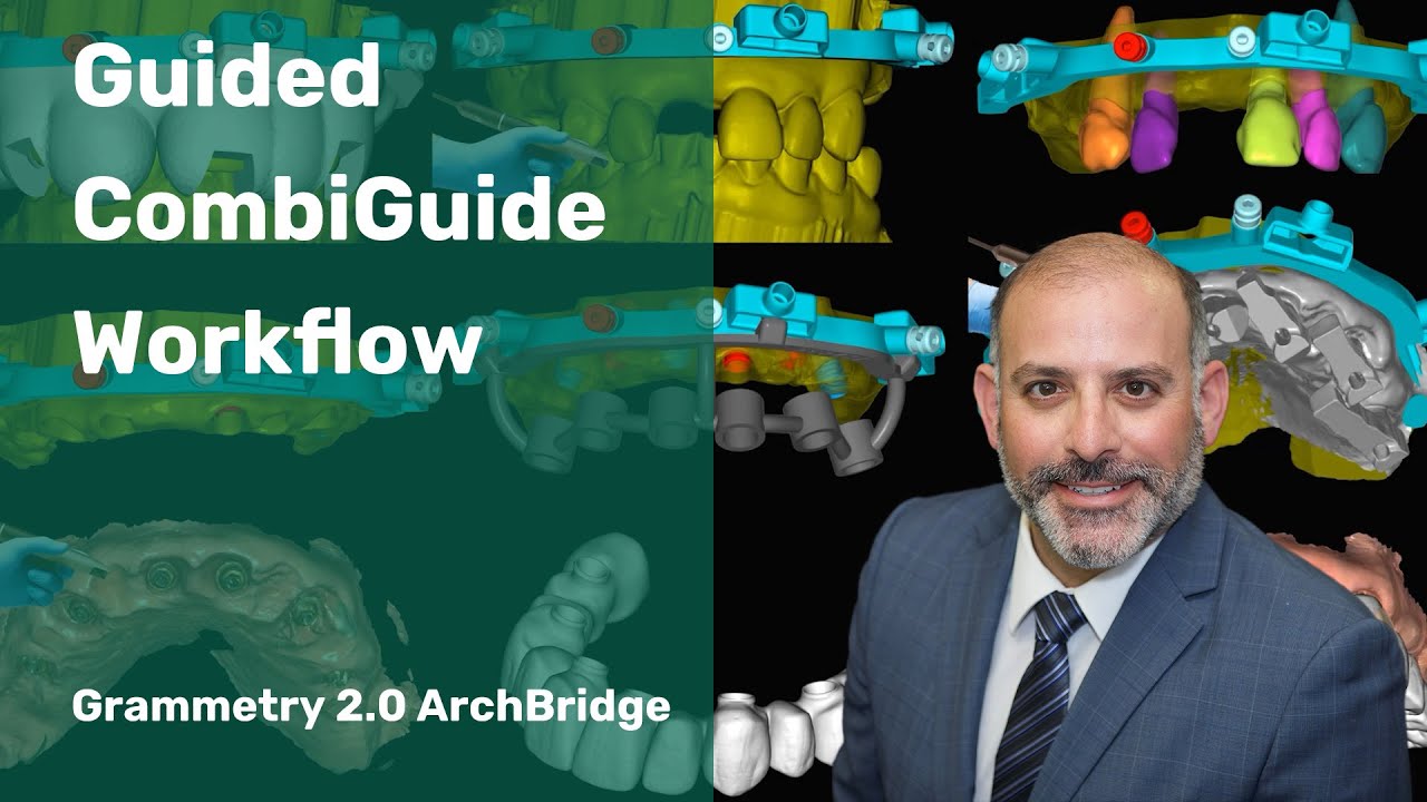 Grammetry 2.0 ArchBridge: Guided CombiGuide Workflow
