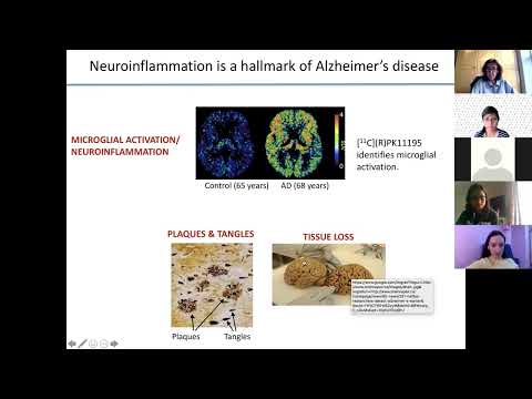 Age-related Disease and Loss of Neuro Function with Prof. Marina Lynch