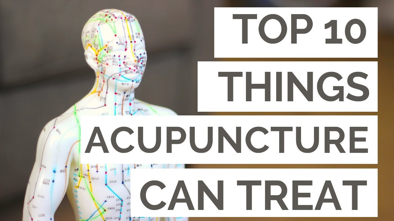 The Top 10 Conditions Acupuncture Can Help