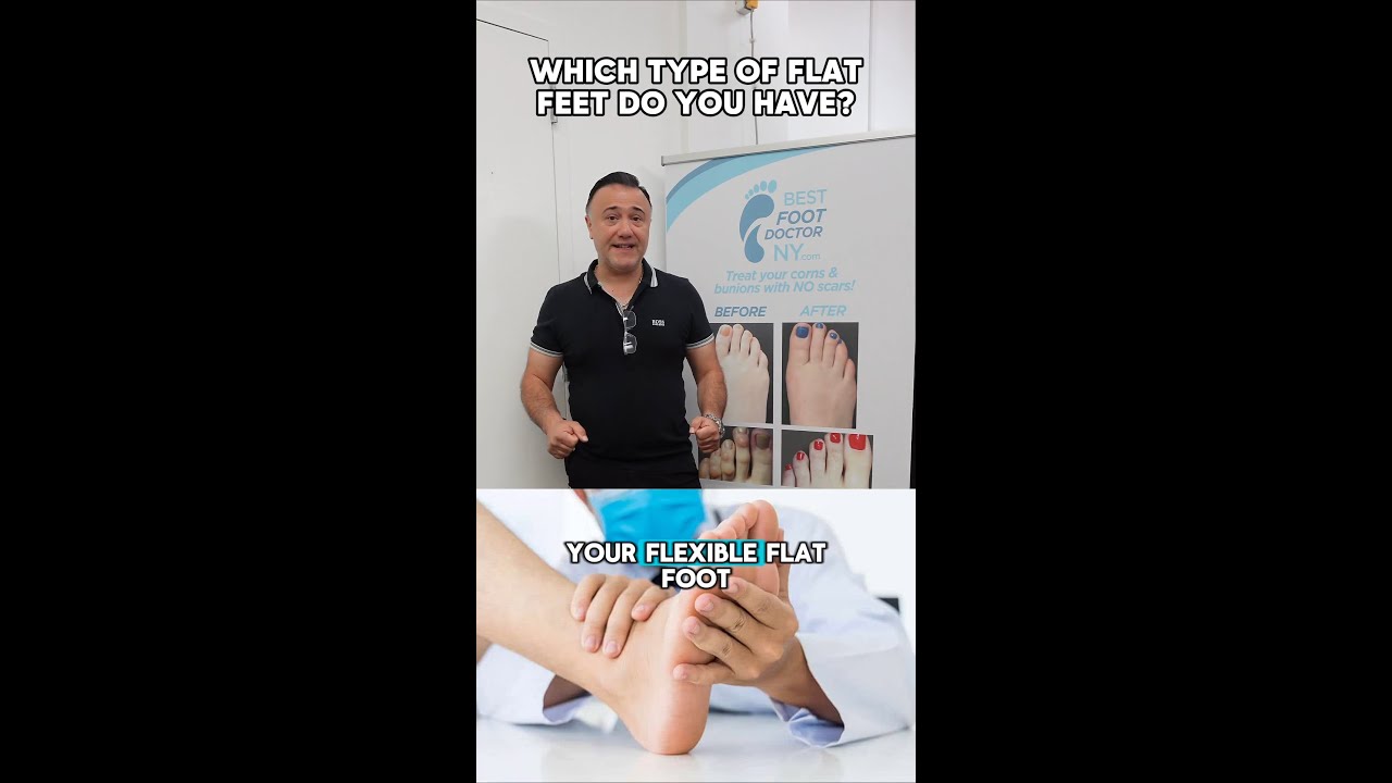 Rigid Flat Foot vs. Flexible Flat Foot: What’s the Difference? 🌟