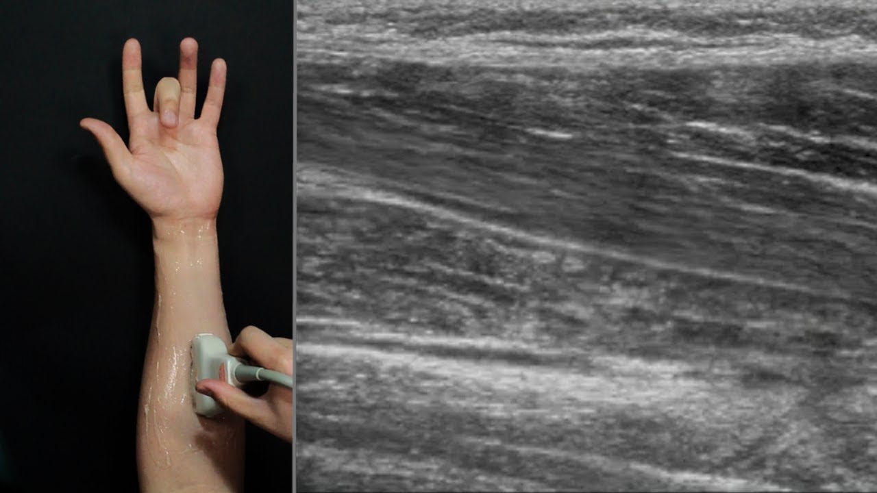 EchoFlex: Hand Gesture Recognition using Ultrasound Imaging