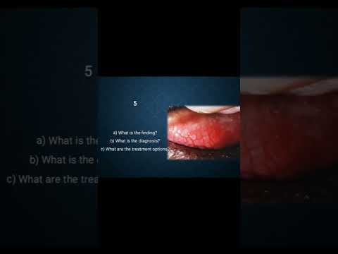 Short Ophthalmology Quiz #doctor #eyes #eyedoctor#optometry #eyedisease #ophthalmology #quiz