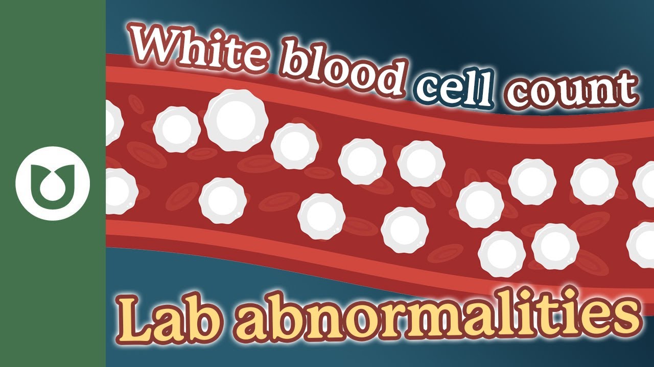 What are the lab abnormalities you will usually see in newly diagnosed AML? #AML