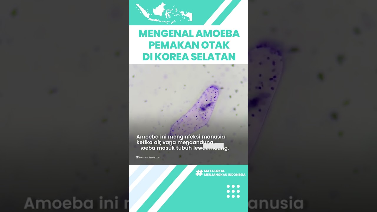 Mengenal Amoeba Pemakan Otak akibatkan Kematian di Korea Selatan, Ini Gejala & Penyebab - Tribun ...