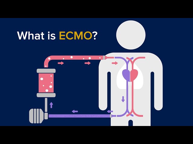 Cardioplegia Delivery Systems - Dicon 34 Cardioplegia Delivery Systems ...
