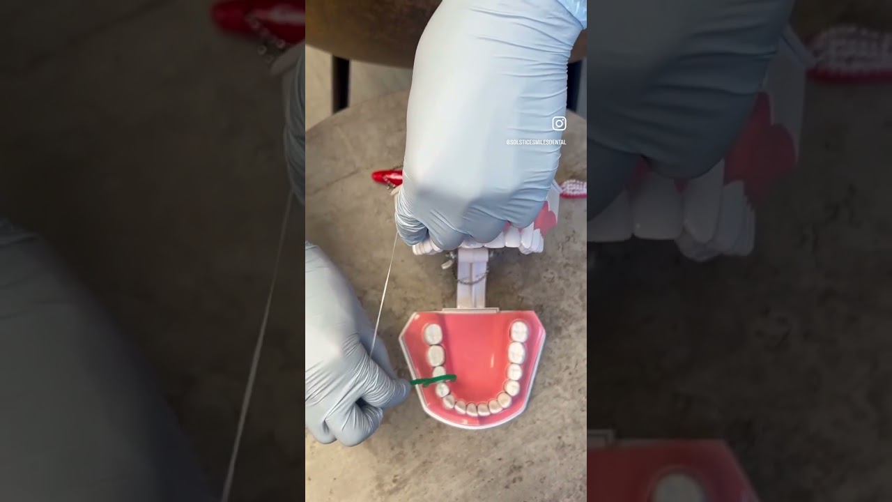 3 Tips for Flossing Your Teeth