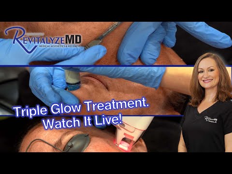 Triple glow treatment only at RMD! Look at this amazing three in one treatment!! Tell us Marissa!