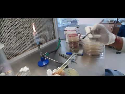 Urease Test | Microbiology | #urease #bacteria #biochemical