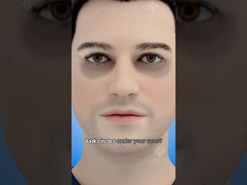 Why Do We Get Dark Circles 😱 #shorts #darkcircles - creativelearning3d