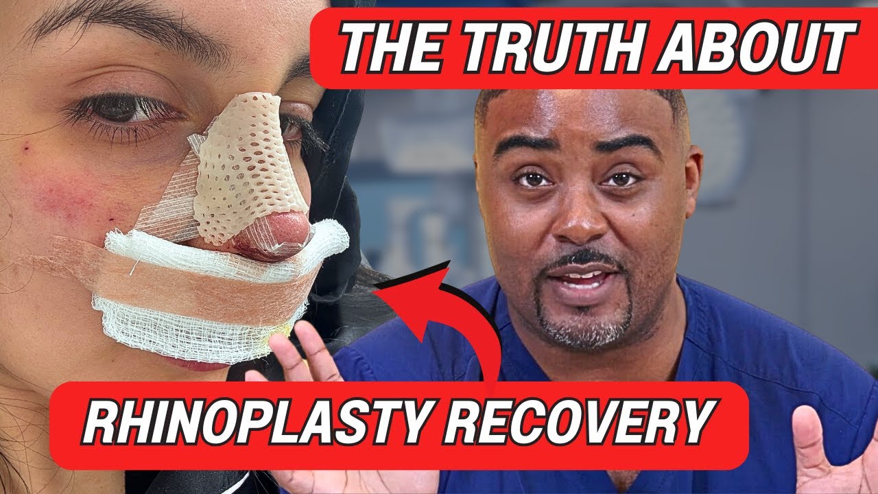Rhinoplasty Recovery: The Honest Timeline & What to REALLY Expect
