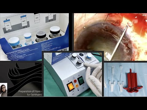 Fibrin Glue at Best Price in India