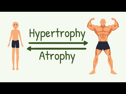 Remodeling of Muscle to Match Function | Hypertrophy, Hyperplasia, Atrophy, Changes in Muscle Length