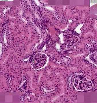 Ledviny histologie – Videomedicina