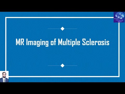 MR Imaging of Multiple Sclerosis | Dr. M. Atif Naveed | Consultant Neuro-radiologist