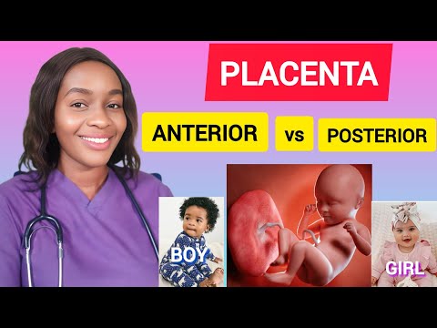 Placenta anterior baby gender/ placenta posterior boy or girl