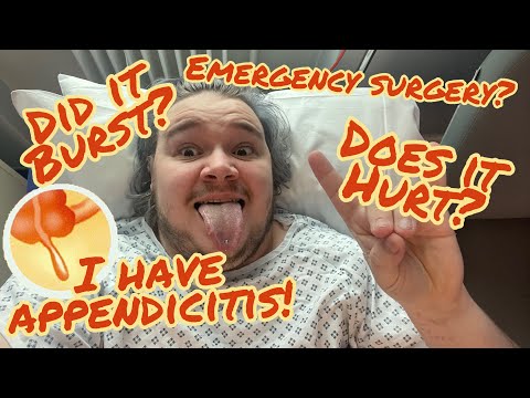 I HAVE APPENDICITIS! DO I NEED EMERGENCY SURGERY?