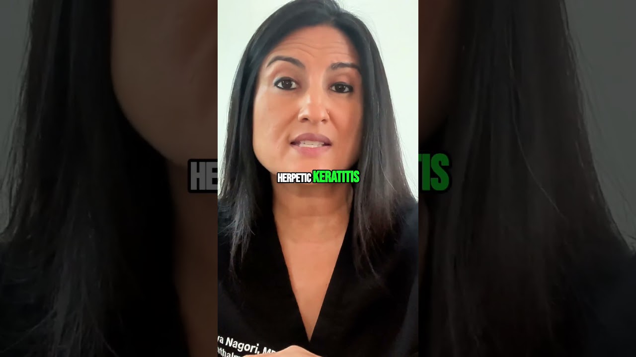 Herpes In The Eye? Doctor explains.