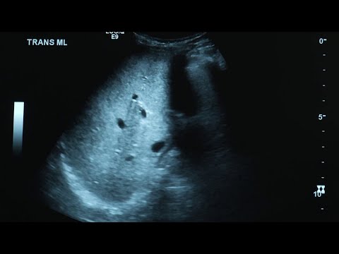 Live Healthy - Nerve Transfer