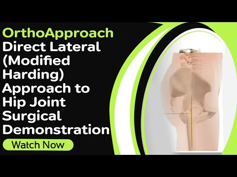 OrthoApproach - Direct Lateral (Modified Harding) Approach to Hip Joint ...