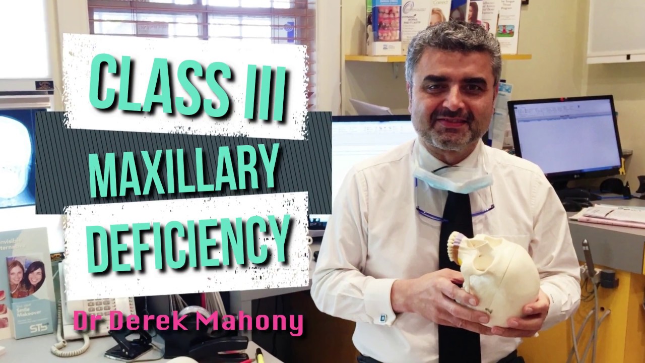 Class III Maxillary Deficiency