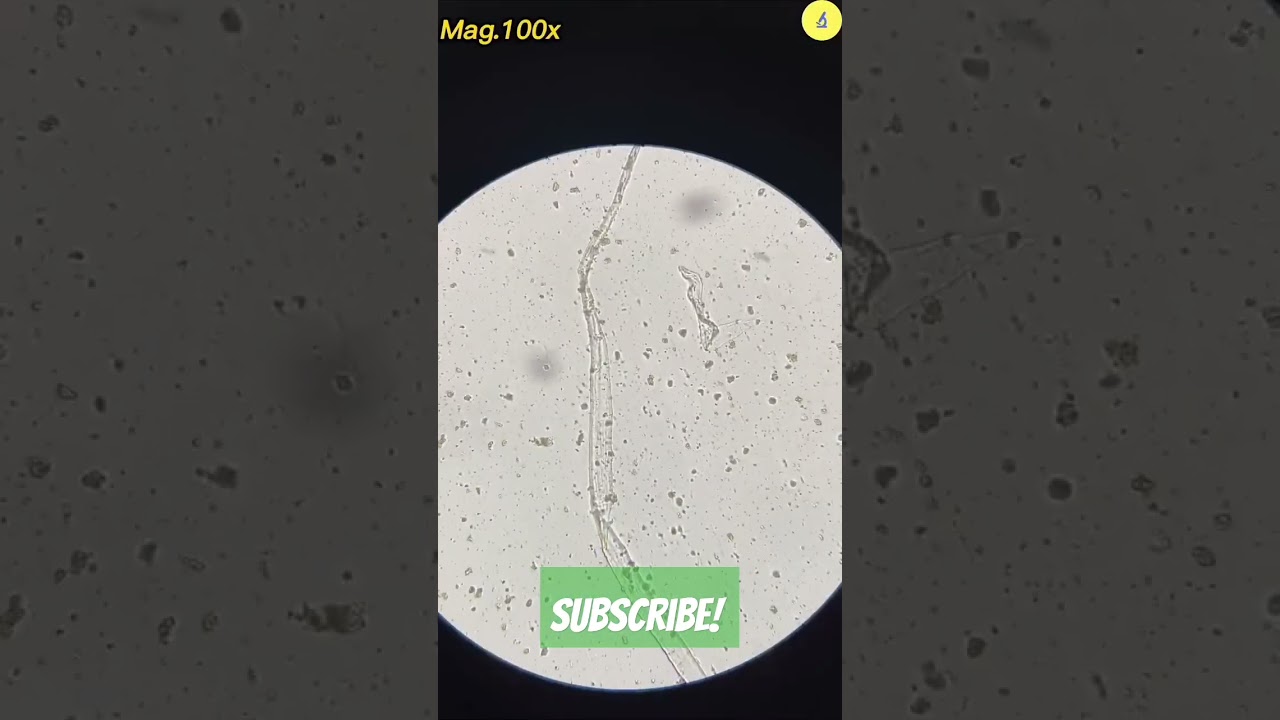 CONDOM UNDER MICROSCOPE.#funny #microscope